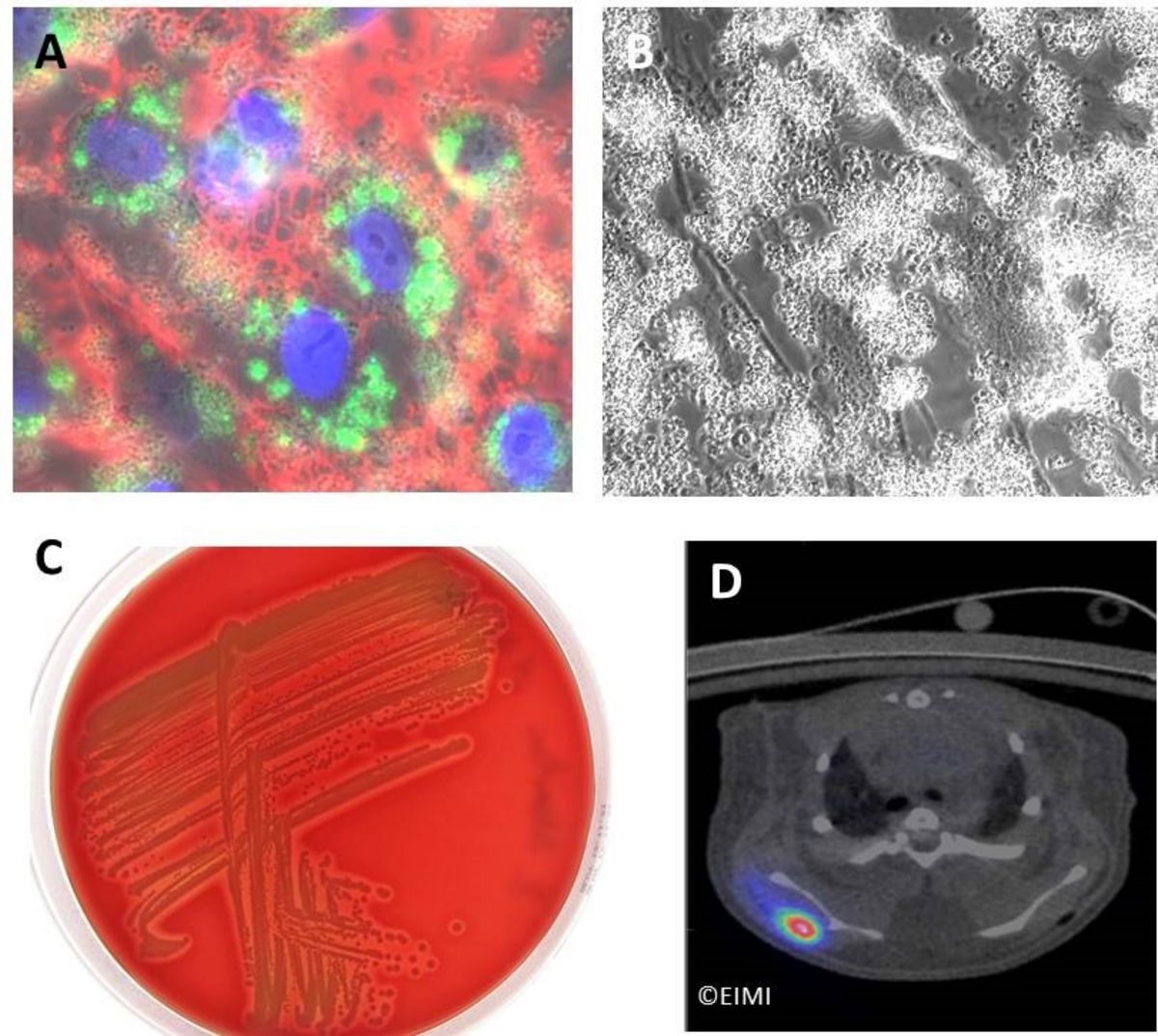 Cellular microbiology