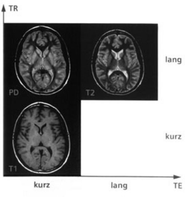 In die Röhre geguckt: MRT
