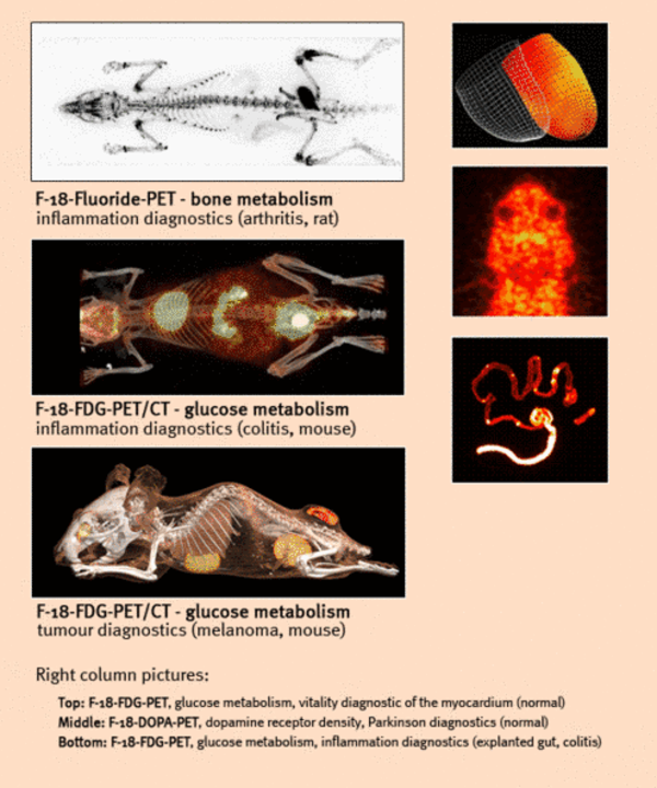 PET-CT/SPECT-CT